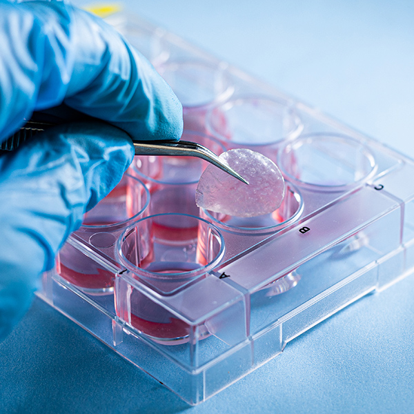 Collagen Cell Carrier® as transferable culture membrane