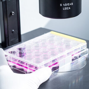 Collagen Cell Carrier® as transferable culture membrane